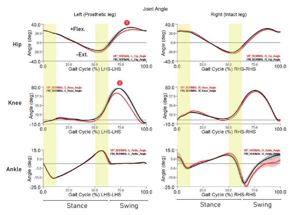 ALPS VIP™ and Pin-Lock Comparative Study